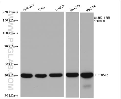 Tdp 43 C Terminal Antibody 81350 1 Rr Proteintech 武汉三鹰生物技术有限公司