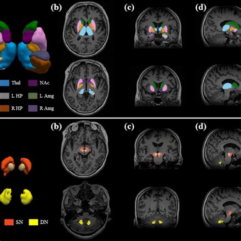 A Segmentation Of The Regions Of Interest Rois In The Deep Brain