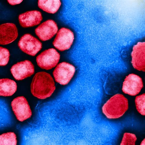 Nih Experts Review Monkeypox Challenges Eurekalert
