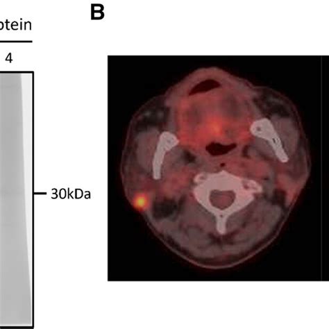A Western Blot Analysis Demonstrates Prominent Serum Immunoreactivity