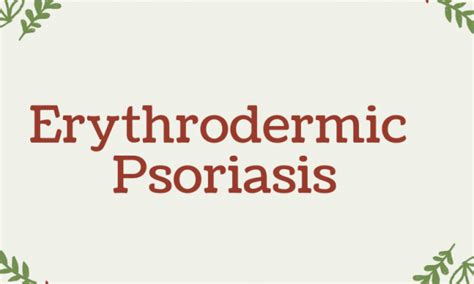 Psoriasis Treatment