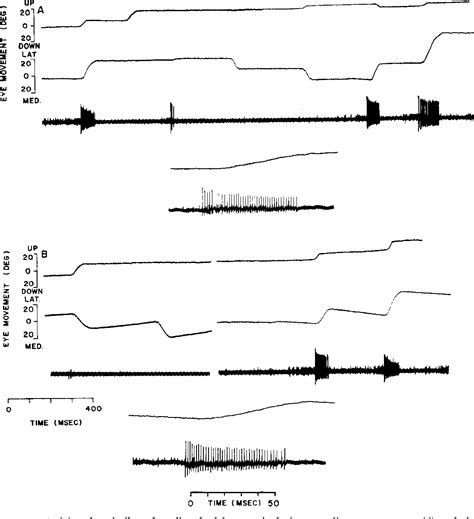 Figure 1 From Participation Of Medial Pontine Reticular Formation In