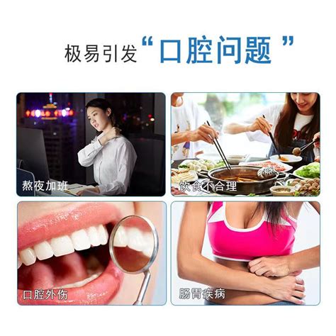牙得安一点灵官方旗舰店口腔溃疡一滴灵非berfer囗腔溃痒修复液SY 虎窝淘
