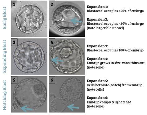 Complete Guide To Embryo Grading And Success Rates Remembryo