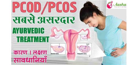 Best Natural Ways To Treat Pcos Story Of A Woman Having Pcos Aasha