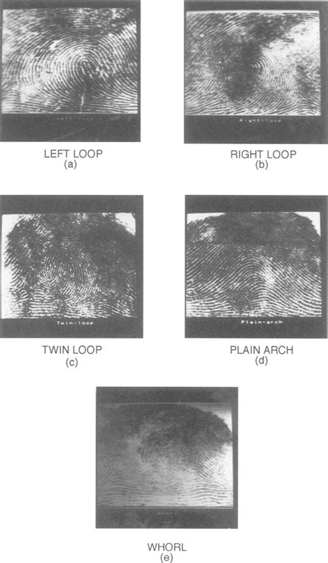 The Five Varieties Of Fingerprint Patterns Used Left Loop Right Loop The Five Varieties Of Fingerprint Patterns Used Left Loop Right Loop
