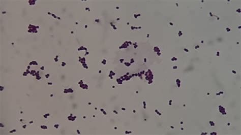 Streptococcus Gallolyticus Introduction Morphology Pathogen