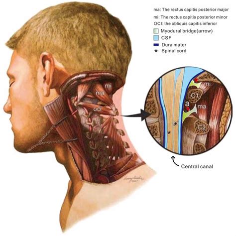 The Myodural Bridge Mdb Connects Muscles To Dural Mater We Presumed
