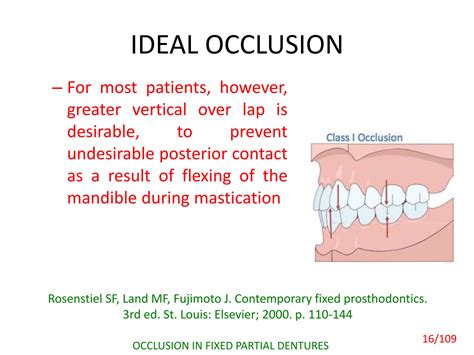 Occlusion In Fixed Partial Denture Pptx