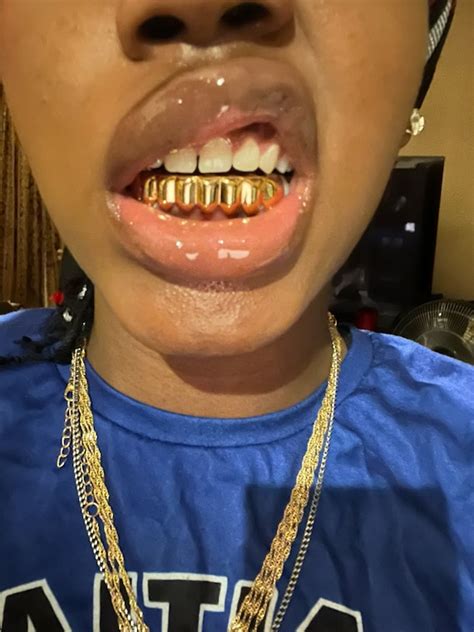 Gold Grillz Teeth