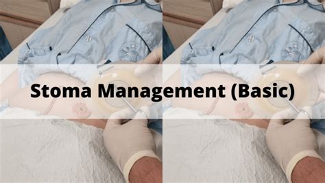 Stoma Management Hmi Institute