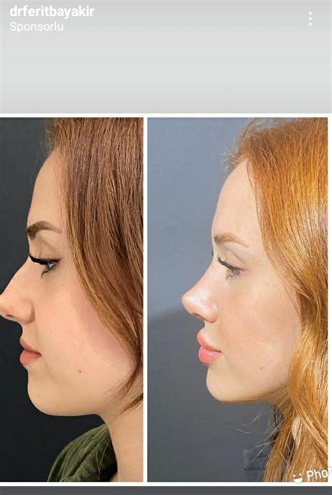 Pin By Esmanurkilicli On Hızlı Kaydedilenler Pretty Nose Perfect