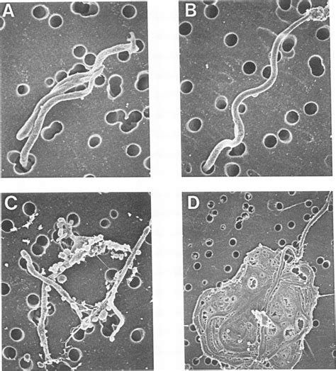 Morphologic Characteristics Of B Burgdorferi In Bsk A Normal Serum