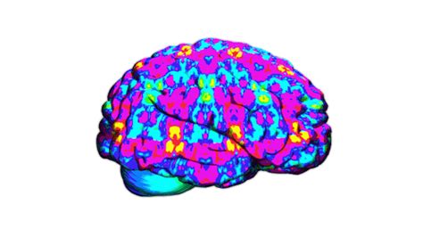 Sistema De Recompensa Del Cerebro ¿cómo Funciona