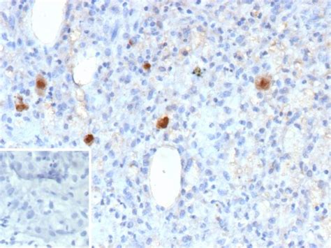 Recombinant Cytomegalovirus P65 Cmv P65 Antibody Clone Rcmv9827