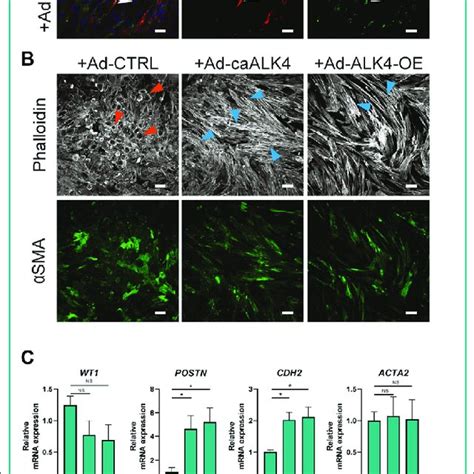 Activin Receptor Alk4 Overexpression Induces Epimt In Adult Epdcs A