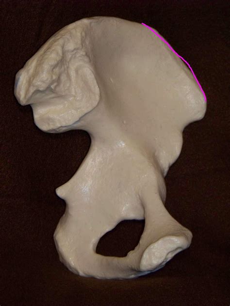 Iliac Crest
