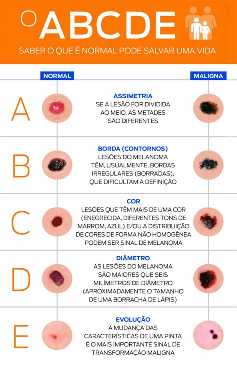 CURIOSIDADES MÉDICAS E CIENTÍFICAS VEJA COMO FAZER O AUTOEXAME DO