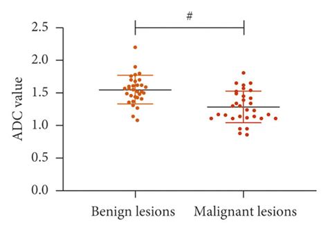 Comparison Between Dwi Parameters Of Benign Breast Tumor Lesions And