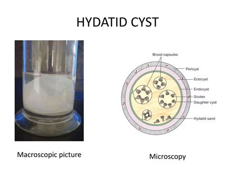 Cestodes Pptx