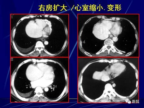 心血管疾病的影像學診斷下如何診斷醫學影像經典PPT 每日頭條