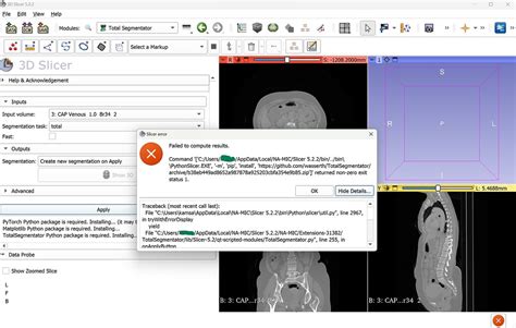 Unable To Use Total Segmentator In Slicer 522 Support 3d Slicer Community