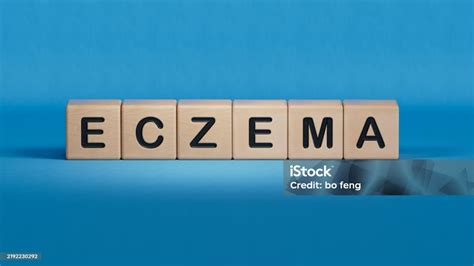 나무 블록은 습진이라는 단어를 형성합니다 의학 개념 병원 클리닉 및 의료 비즈니스를 위한 의료 개념 파란색 배경에 렌더링하는