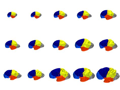 Constrained Spectral Segmentations Of Fetal Brains With Preserved