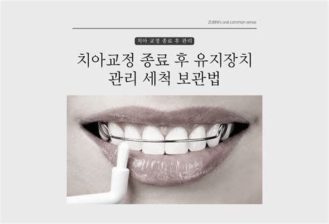 데니저가 알려주는 치아교정 종료 후 가철식고정식 유지장치 관리 세척 보관법 구강 상식