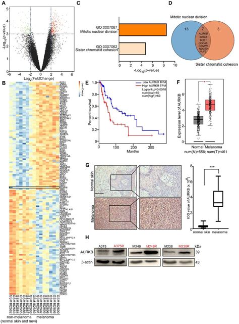 Database Analysis And Aurkb Expression Level In Melanoma A Volcano