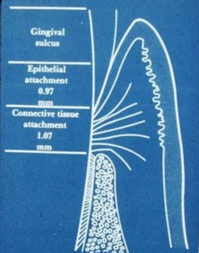 Occlusion In Periodontics Flashcards Quizlet