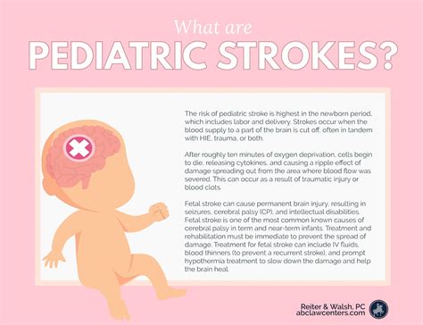 Fetal Stroke Strokes In Utero Fetal Stroke Attorneys And Lawyers
