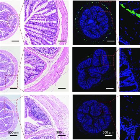 Hande And If Staining Of Colon Tissue In The Control Group And Narrow