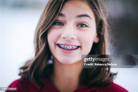 Pretty Girl With Braces Photos And Premium High Res Pictures Getty Images