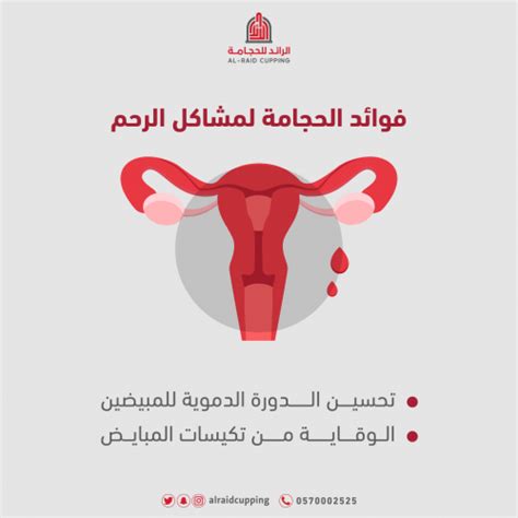 الرائد للحجامة الرائد للحجامة
