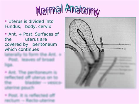 SOLUTION Modified Female Pelvis Studypool
