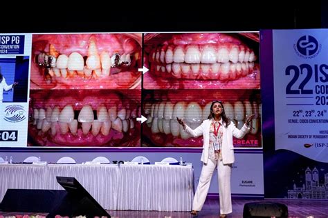 Isppgconvention Boneandsofttissueaugmentationinimplantology Boneandsofttissue