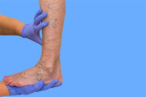 Great Saphenous Vein Anatomy Function Significance