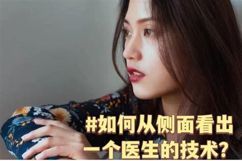妈生鼻隆鼻6个月，终于轮到我成功上岸~顺便分享一些面诊小技巧之如何跟医生有效沟通。 知乎