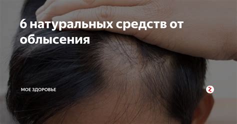 6 натуральных средств от облысения | Мое здоровье | Дзен