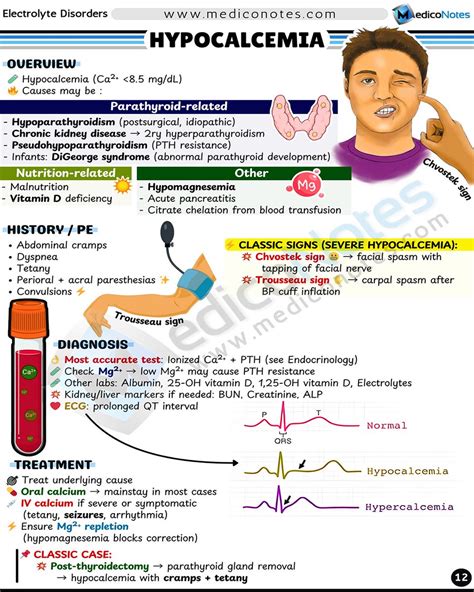 💡 Hypocalcemia Low Calcium Think Neuromuscular Irritability ⚡ Heres
