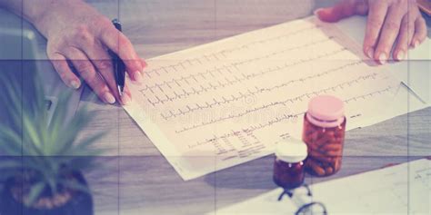 Female Cardiologist Examining An Ecg Graph Geometric Pattern Stock