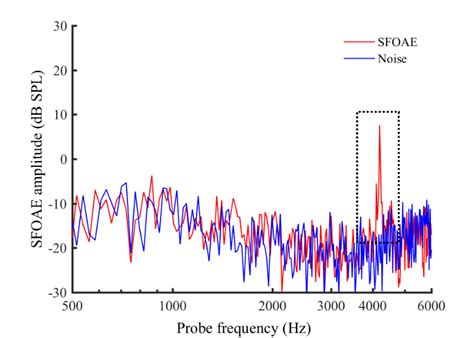 An Example Of The Presence Of Stimulus Frequency Otoacoustic Emission Download Scientific