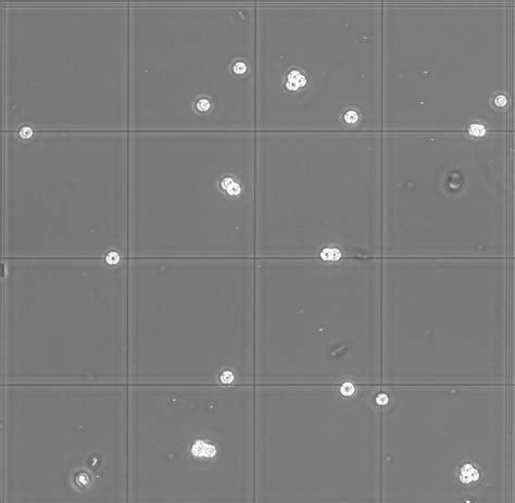 Like Cell Counting O3uab Protoplast Detector 3 Roboflow Universe Search