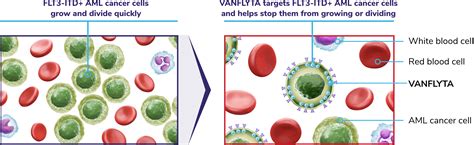 What Is Vanflyta Vanflyta® Quizartinib