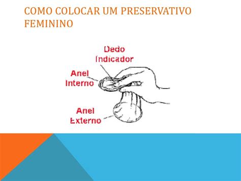 Métodos Contraceptivos De Barreira
