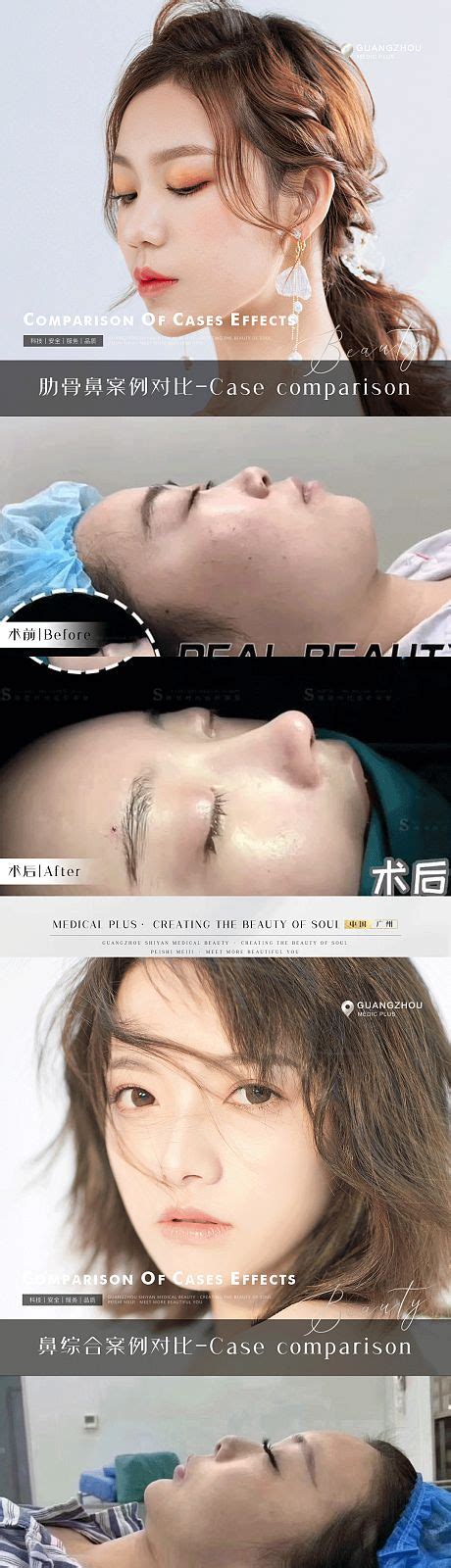 医美眼综合海报psd广告设计素材海报模板免费下载 享设计
