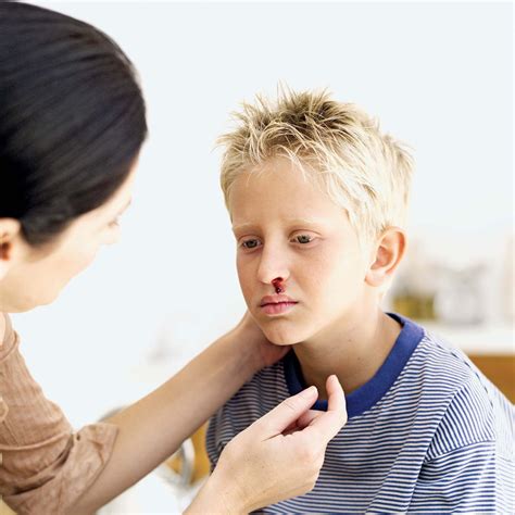 آنچه در مورد خون دماغ شدن کودکان باید بدانید شفاجو