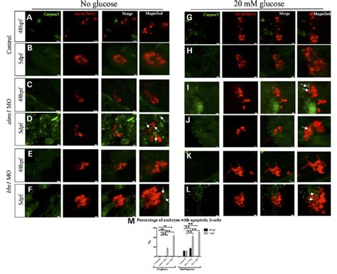 Depletion Of Alms1 And Bbs1 Leads To Apoptosis Of β Cells Whole Mount