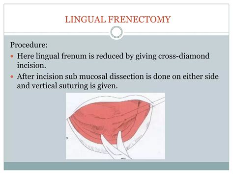 Pre Prosthetic Surgery Pptx Dental Health Diseases And Conditions
